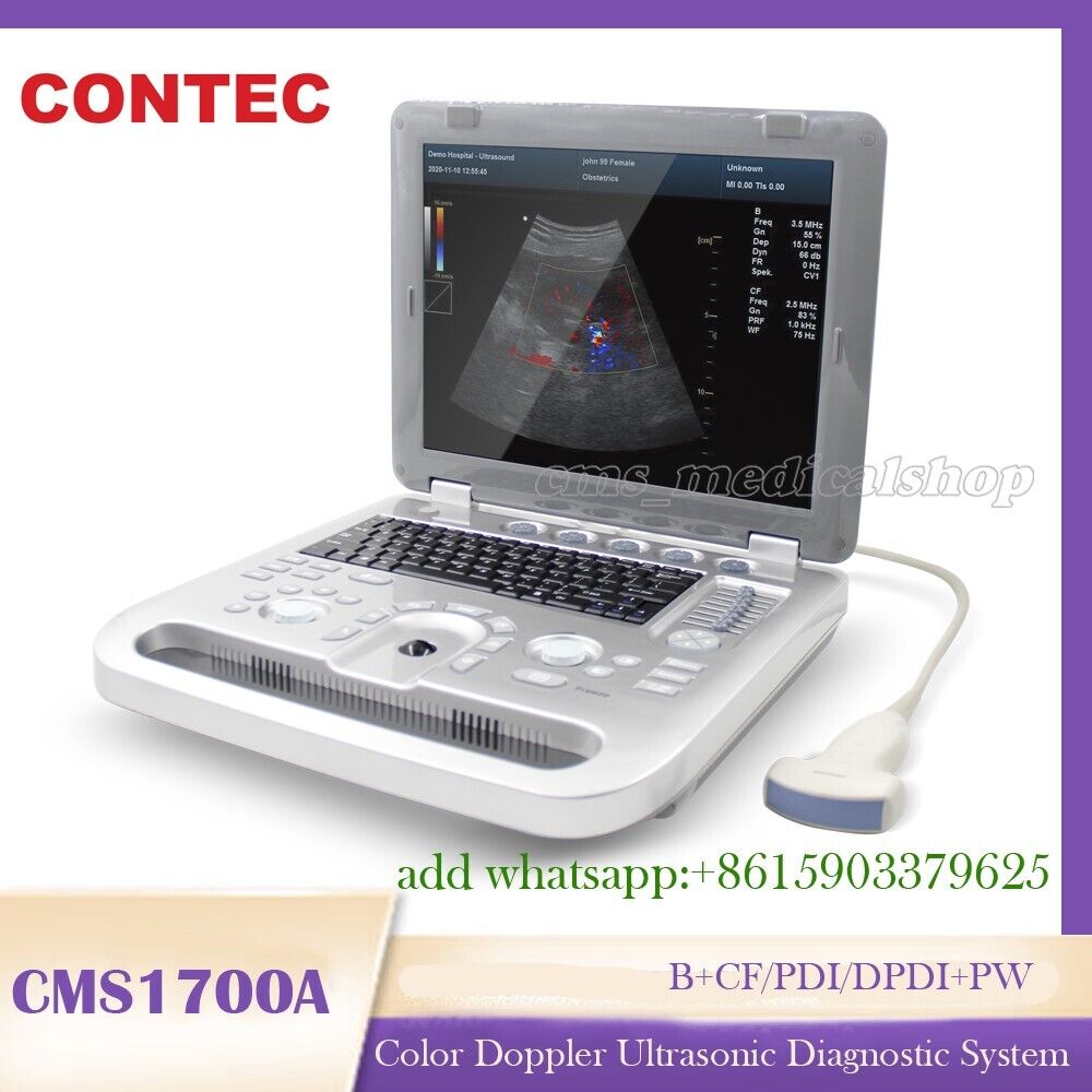 Portable Laptop Machine Color Doppler Diagnostic Ultrasound Scanner ...
