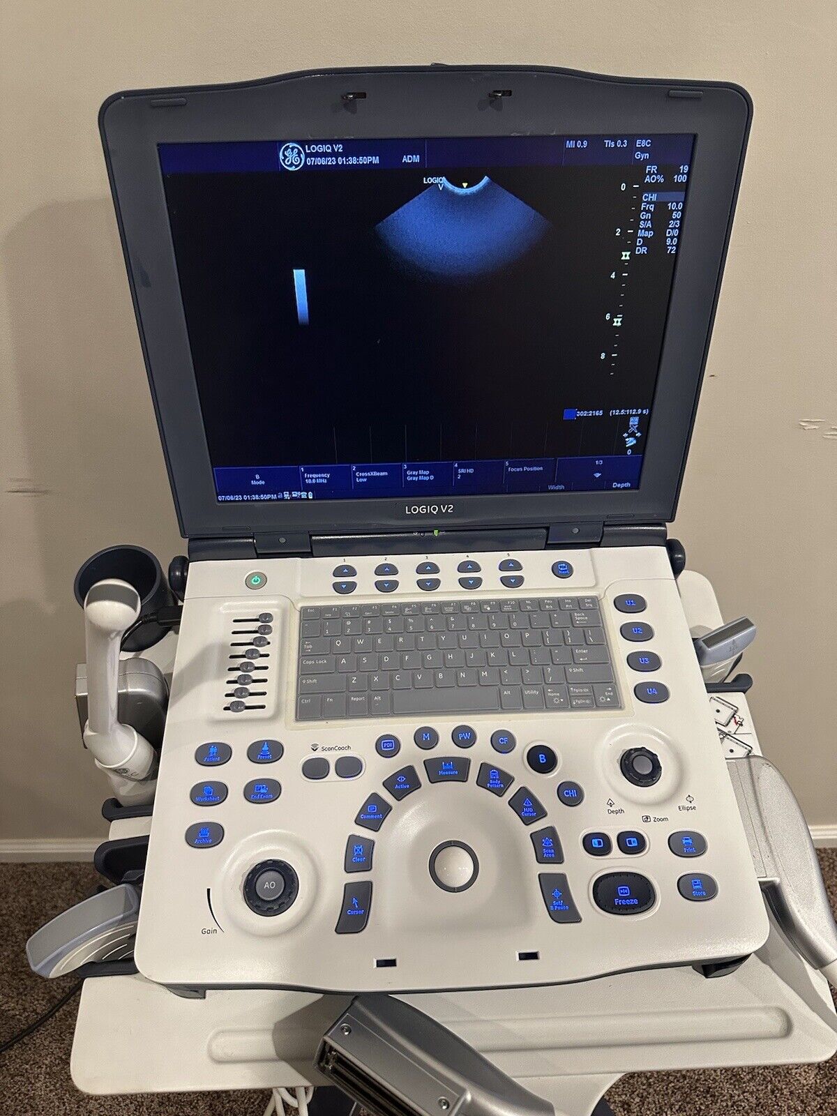 GE Logiq V2 Ultrasound Machine With 2 Probes And Cart | Ultrasound ...