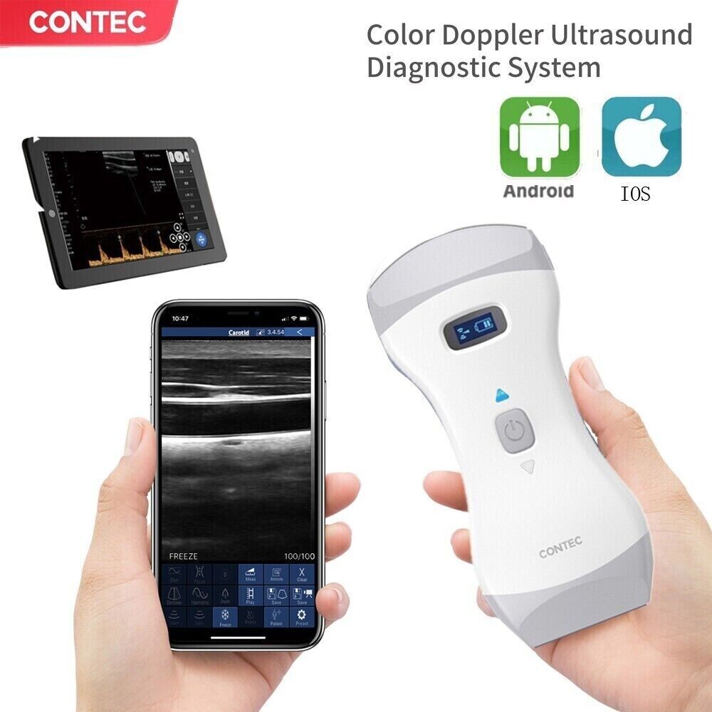 Portable Wireless Ultrasound Scanner Color Doppler Machine Convex ...