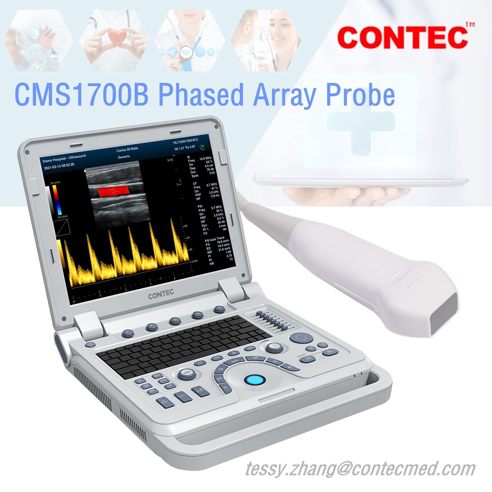 CMS1700B Color Doppler CF Ultrasound Scanner Phased Array Laptop ...