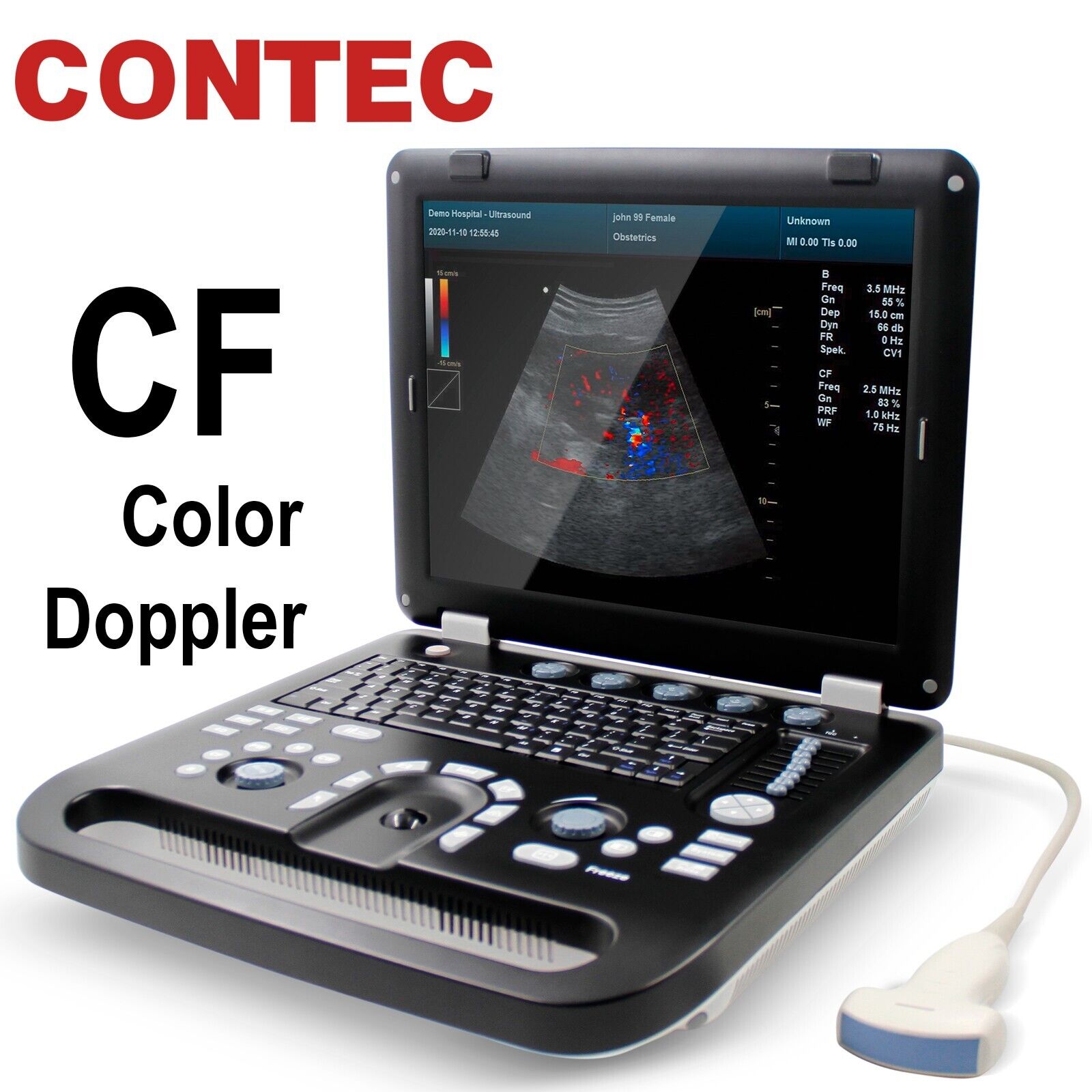 Portable Color Doppler Laptop Digital Ultrasound Scanner Machine CONTEC ...