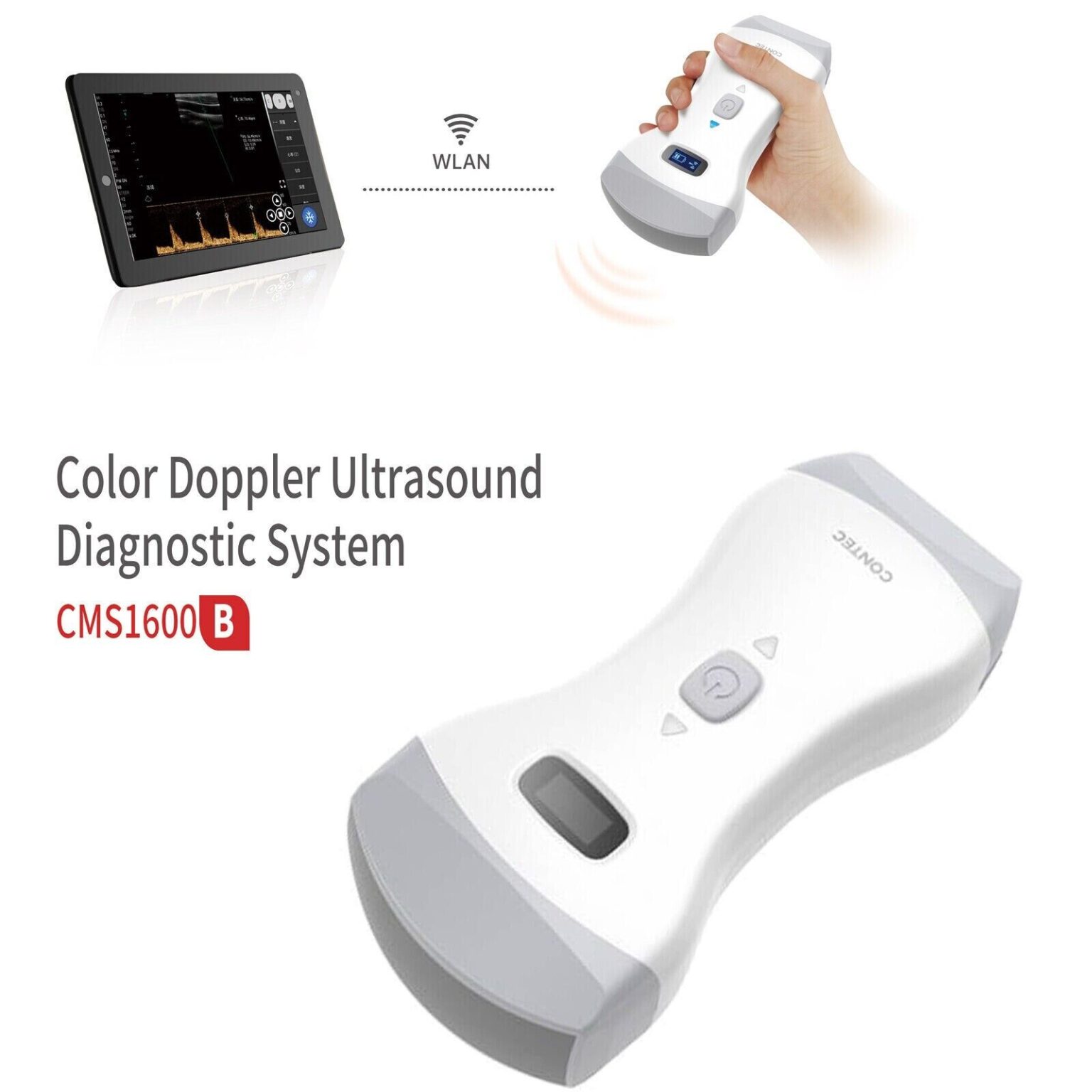 CMS1600B Wifi Wireless Ultrasound Machine Scanner Handheld Color ...