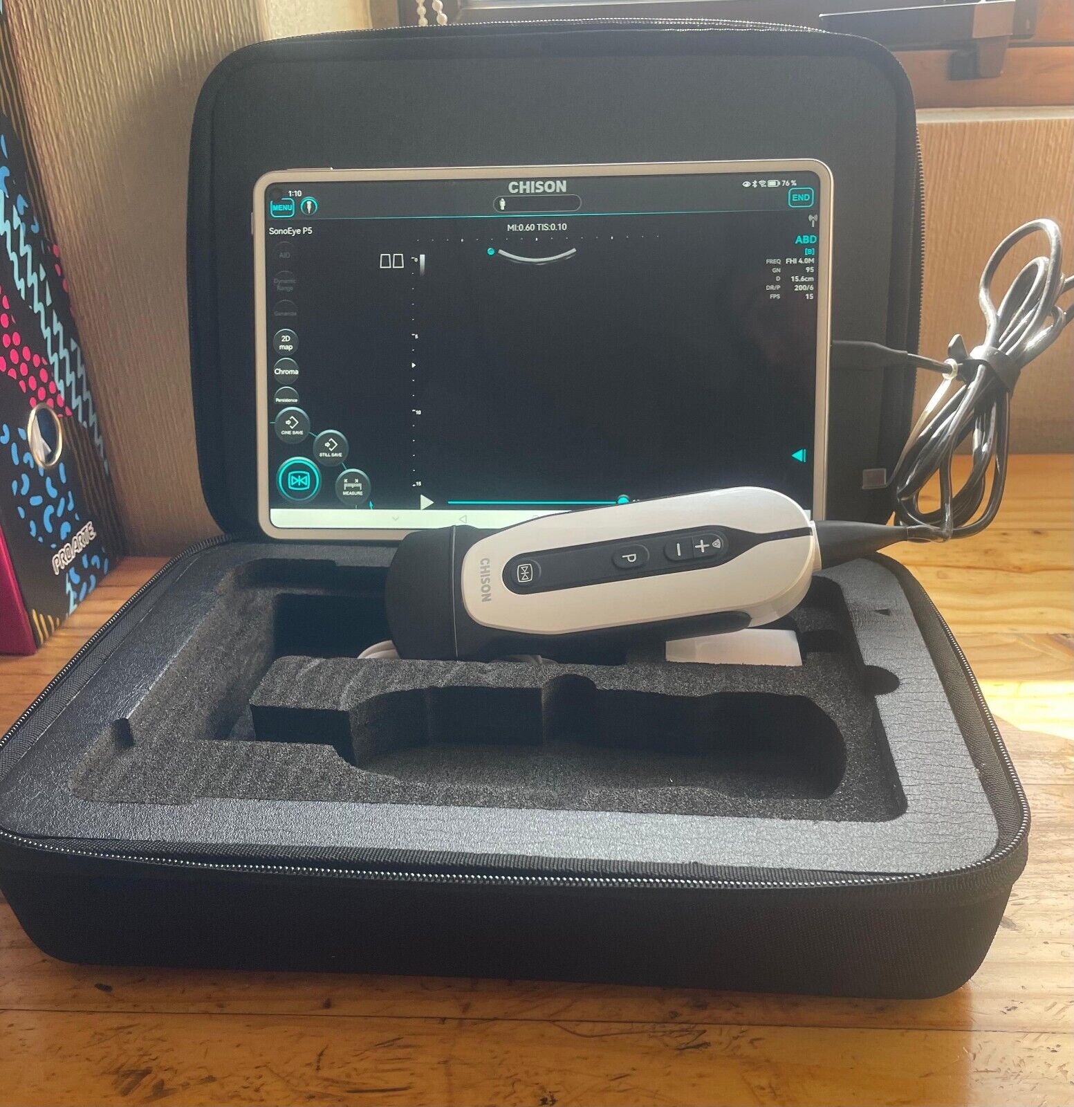 Chison Sonoeye Convex (Portable Ultrasound Machine) | Ultrasound ...