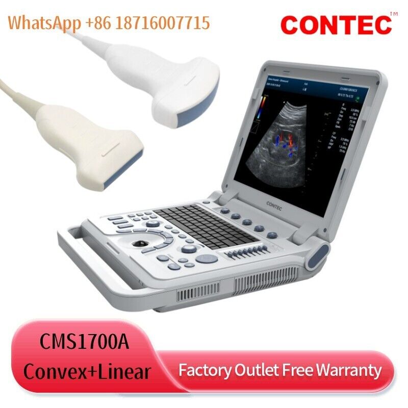 New Color Doppler Ultrasound Scanner Laptop Machine USG Diagnostic ...